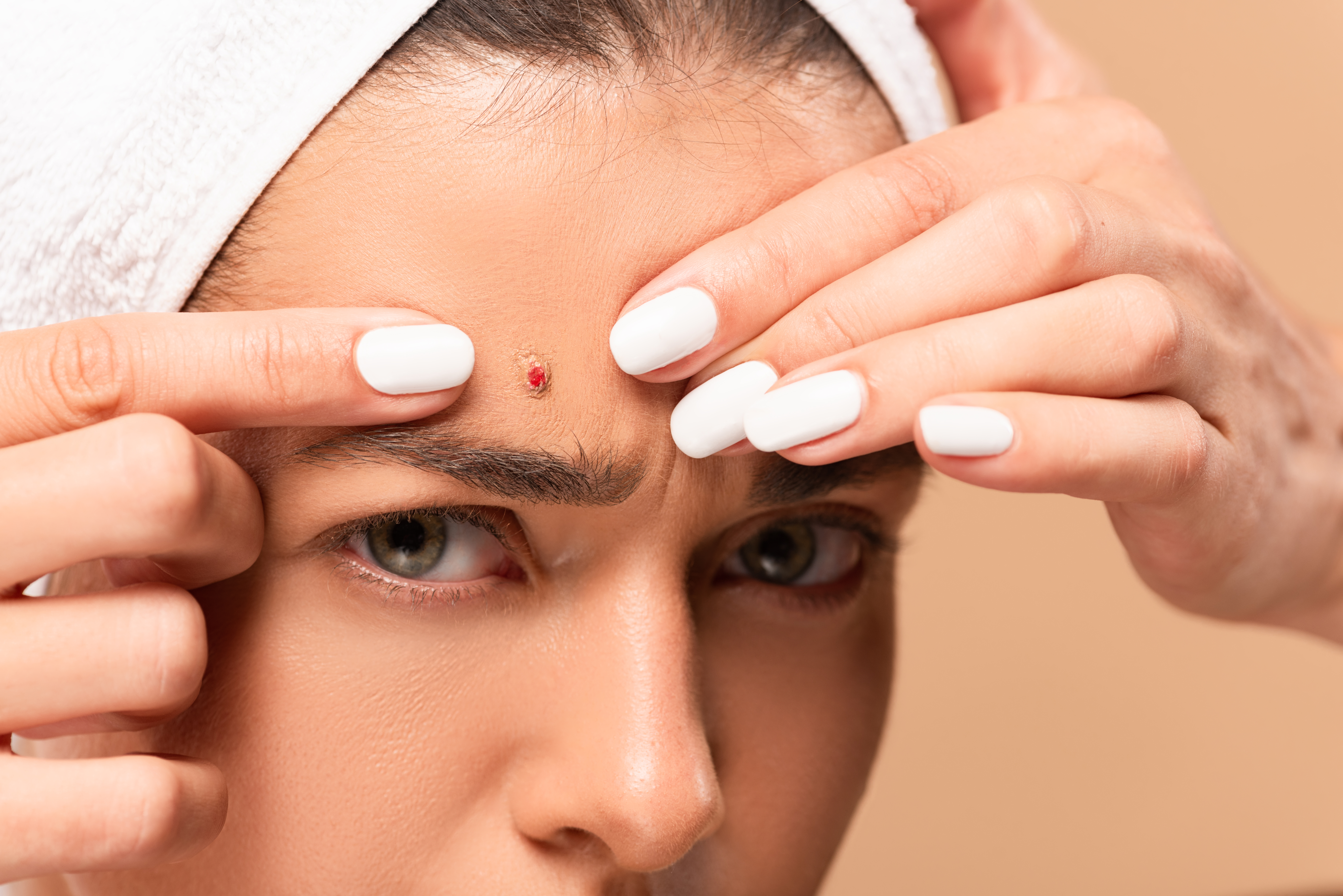 https://www.dnaskinclinic.in/blog/forehead-acne-treatments